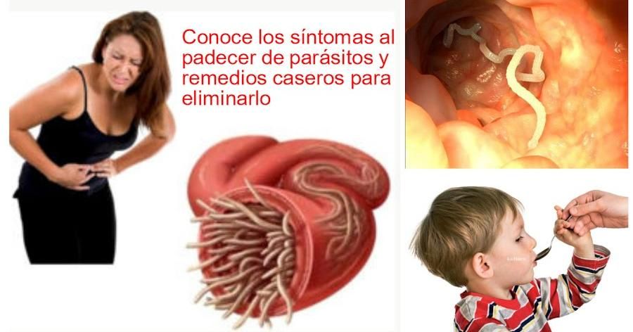 Síntomas de tener parásitos y remedios caseros para eliminarlos | Salud ...